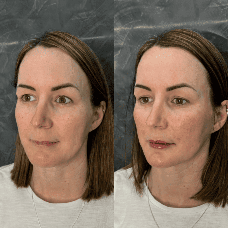 Home | Dermal Fillers & Botox Belfast | Dr Amy Aesthetics